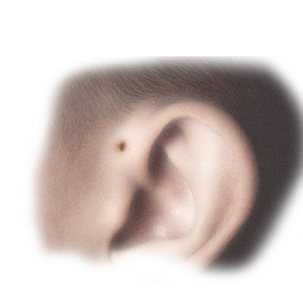 Doenças da Face e Região Cervical - Dra. Renata Fonseca